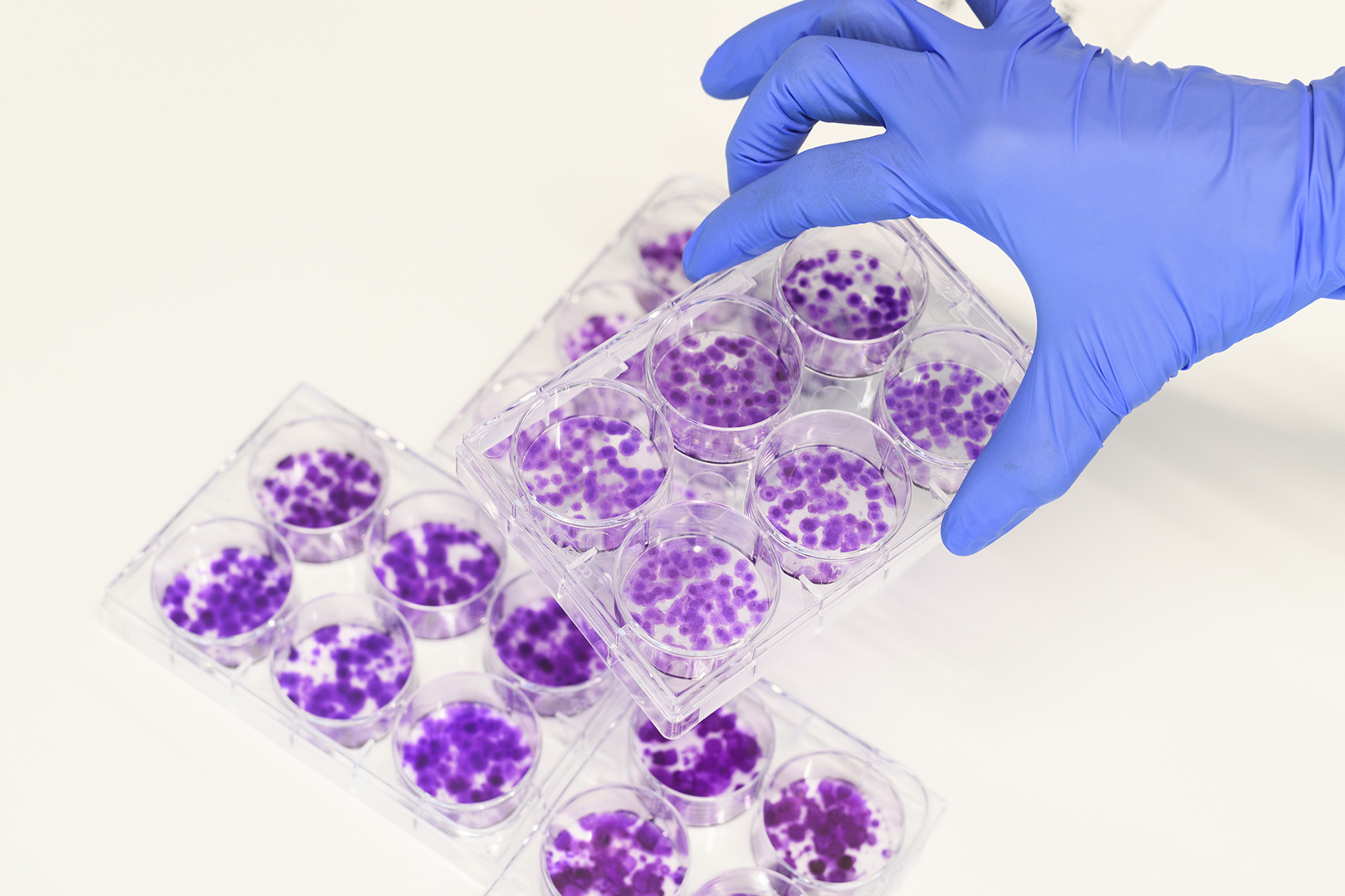 La recherche au CHUV | CHUV