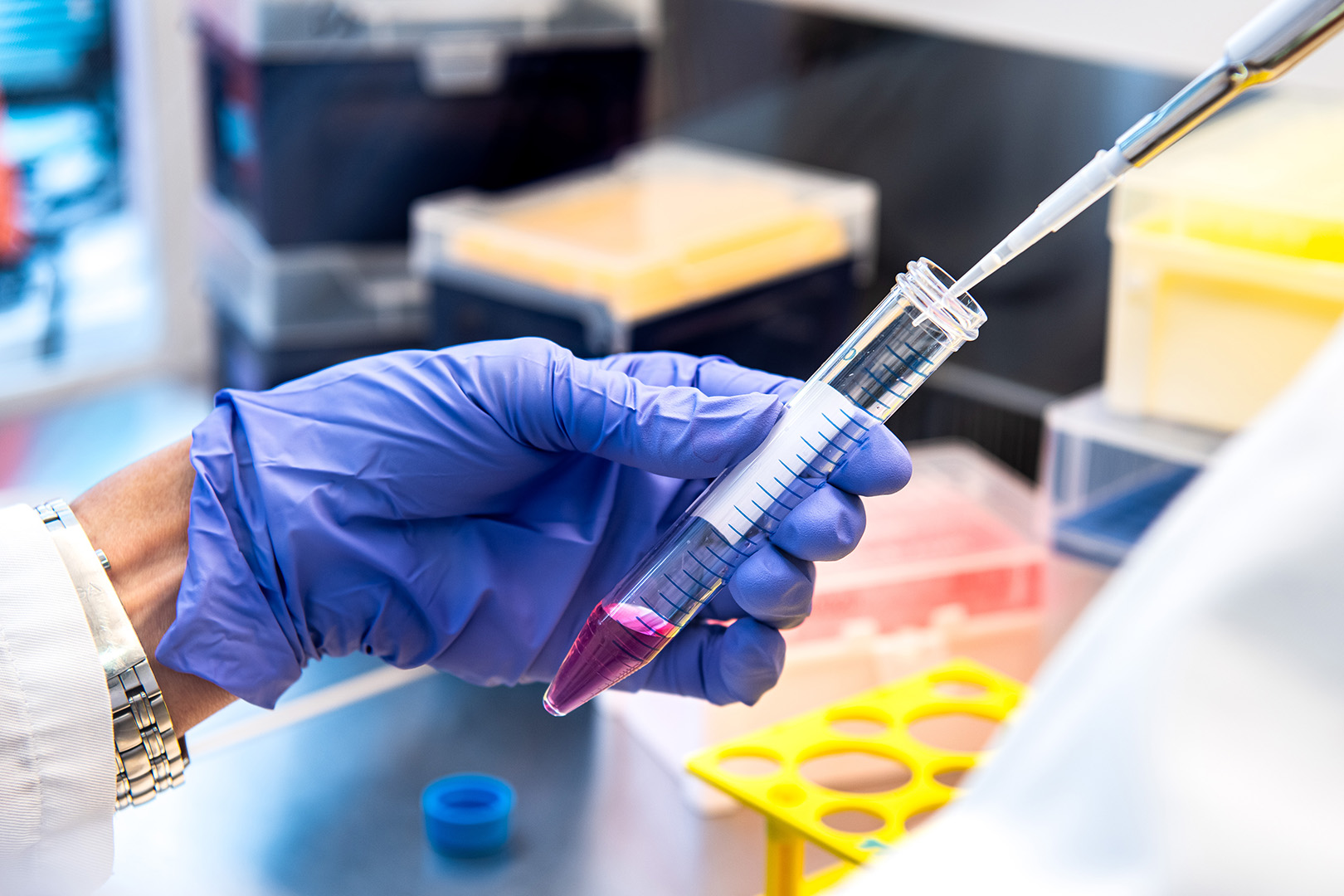 La recherche au CHUV | CHUV