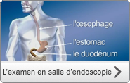 Gastroscopie - Service de gastro-entérologie et d’hépatologie - CHUV